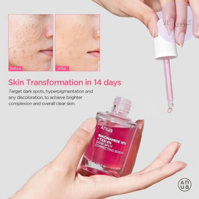 سرم نیاسینامید آنوا Anua ترانگزامیک اسید روشن کننده - فروشگاه کیووی کالا
